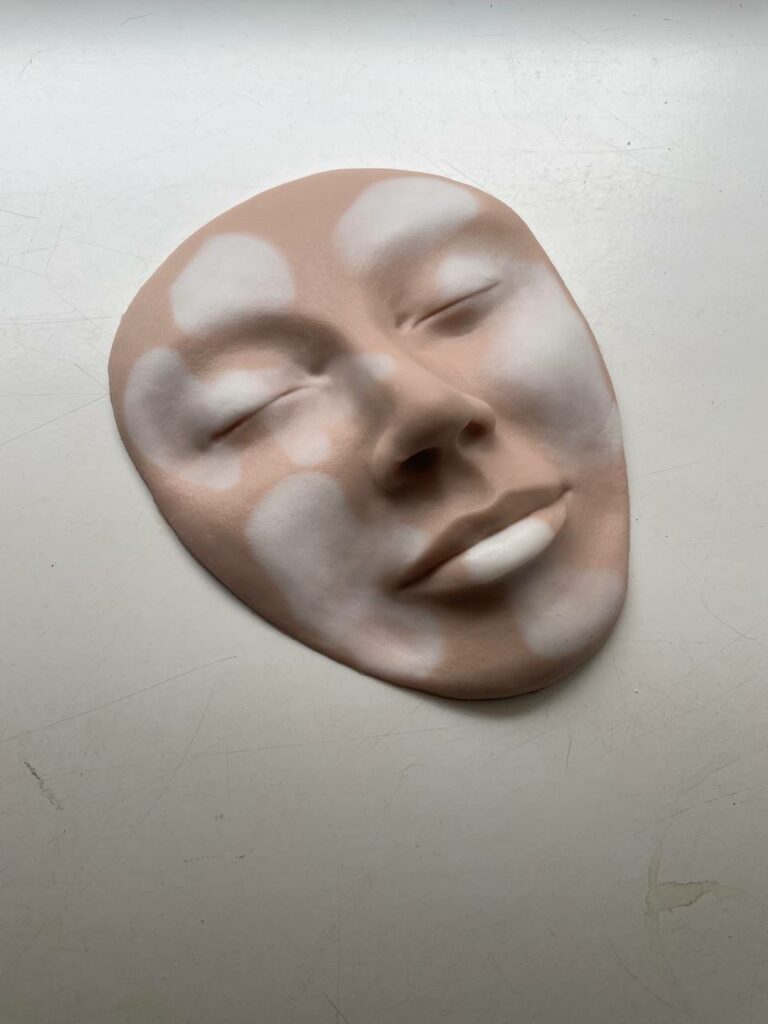 Vitiligo face – Training skin